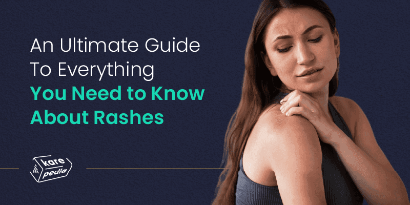 An Ultimate Guide To Everything You Need to Know About Rashes