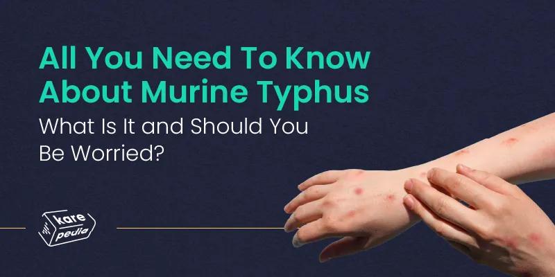 All You Need To Know About Murine Typhus: What Is It and Should You Be ...